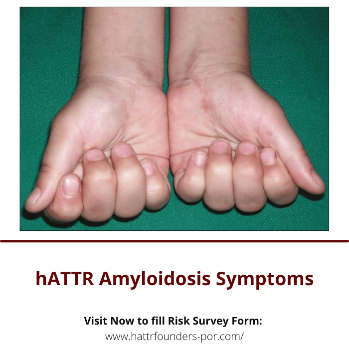 hereditary ATTR amyloidosis | A Listly List